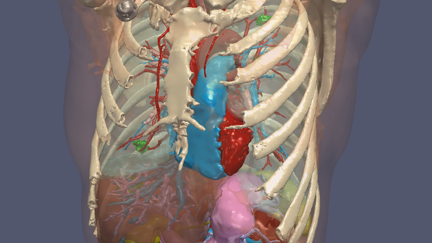 Research | Radiology | Medical School | Brown University